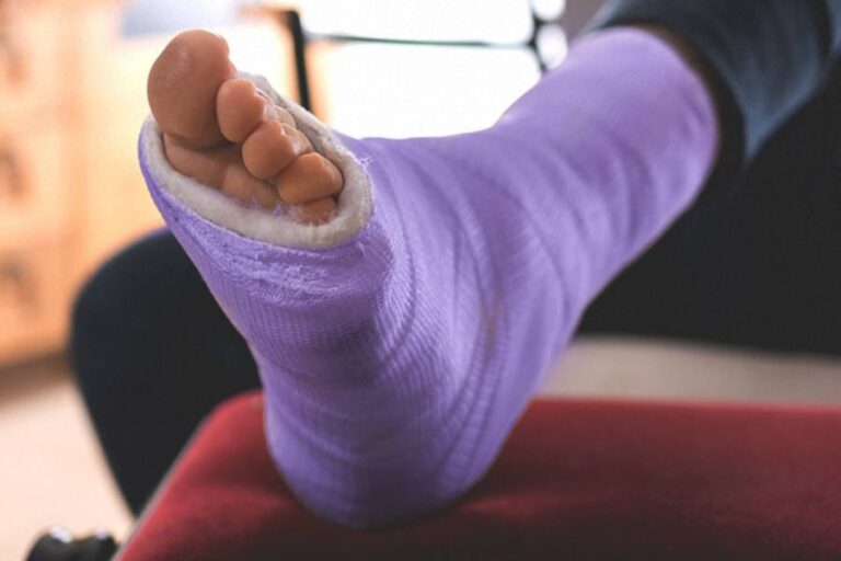 Trauma & Fracture - Dr. Prashant Kale